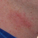 How to Prevent Irritations and Burns from Electric Shavers